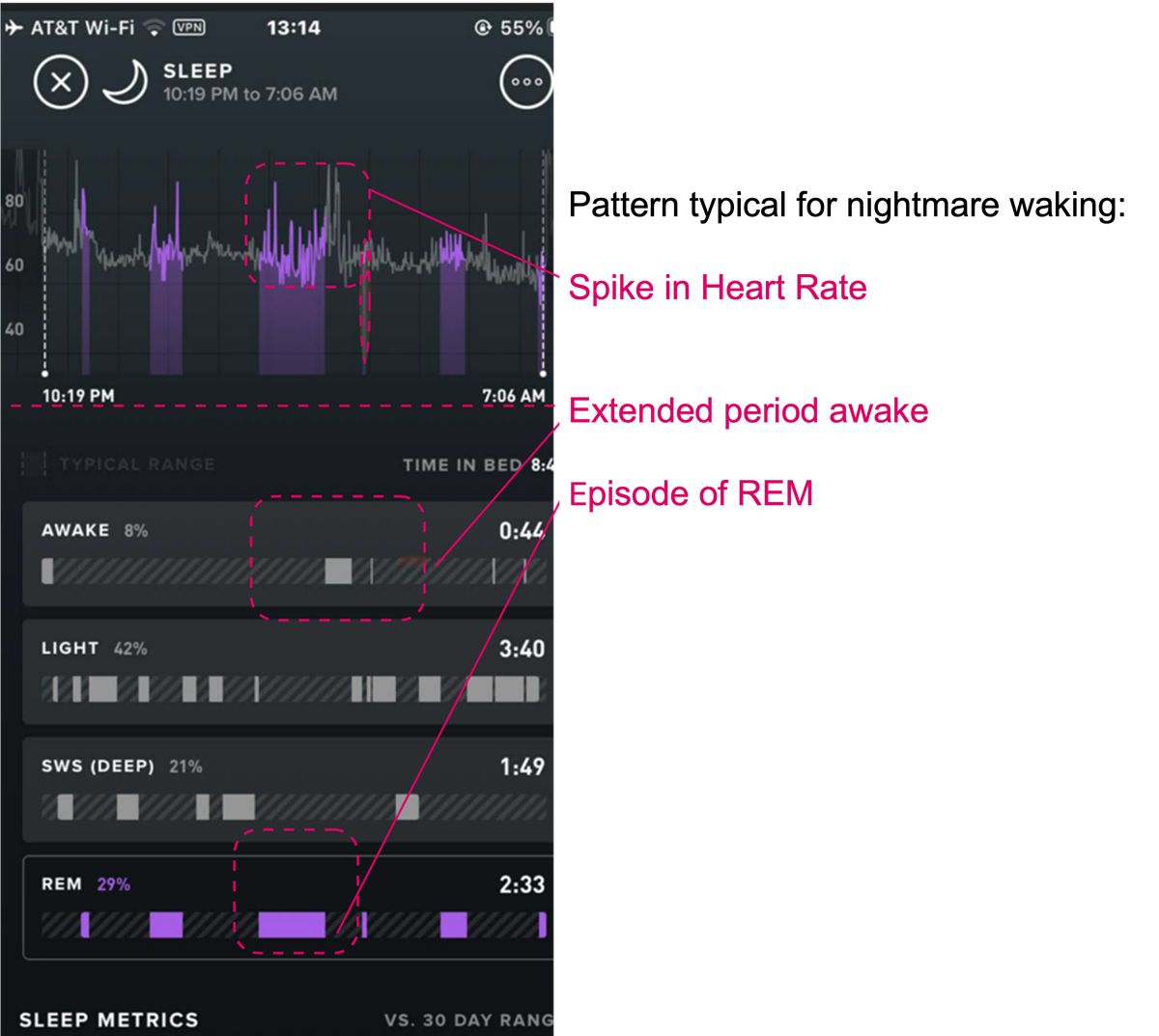 SleepGuard | Elisa G. de Lope